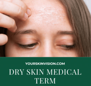 Dry Skin Medical Term: Symptoms, Causes, And Treatment