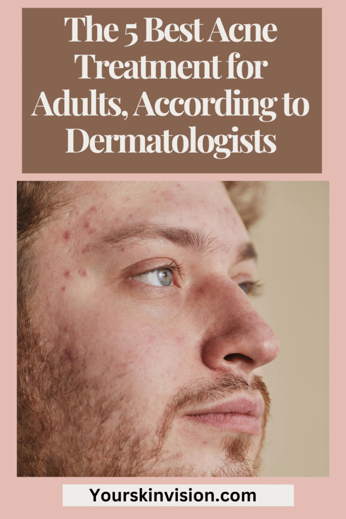 The 5 Best Acne Treatment for Adults, According to Dermatologists ...