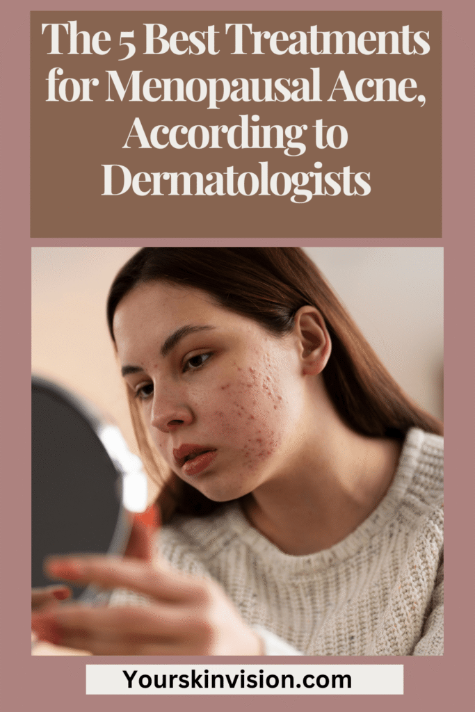 Best Treatments for Menopausal Acne, According to Dermatologists