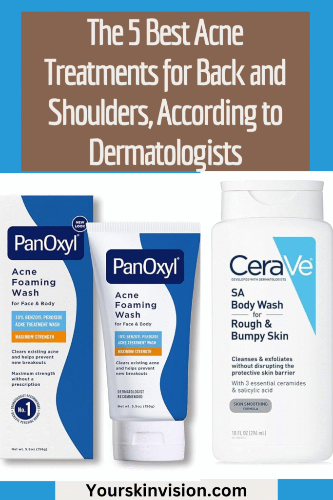 5 Best Acne Treatments for Back and Shoulders Backed by Derms