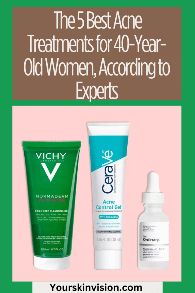 The 5 Best Acne Treatments for 40-Year-Old Women